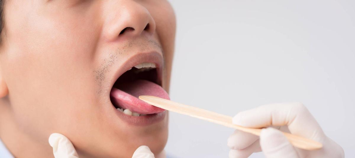 Puntos blancos en la garganta o candidiasis oral: ¿cuáles son sus ... Puntos blancos en la garganta o candidiasis oral: ¿cuáles son sus ...