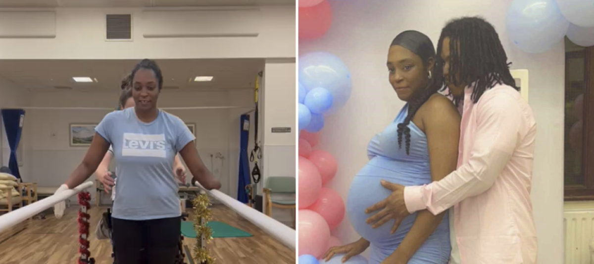 A madre le tuvieron que amputar piernas, dedos y una mano días después ...