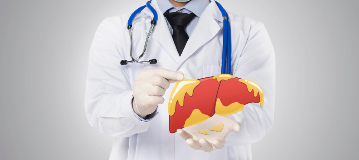Si quiere mantener su hígado saludable, tendría que evitar estos ...