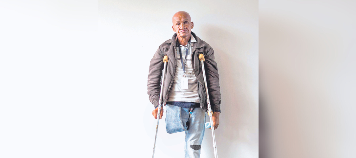 El atardecer en el que el infierno le amputó la pierna a Henry Moreno