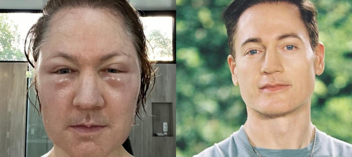 El multimillonario creador de Blueprint, proyecto de longevidad, se ...