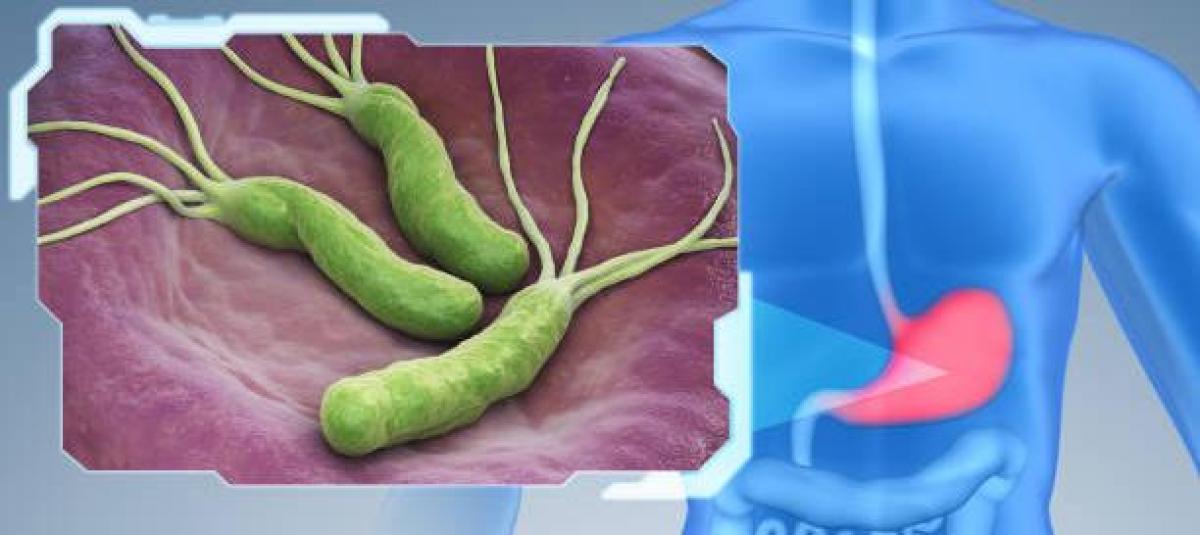 Estos son los primeros síntomas de la bacteria Helicobacter pylori y ...