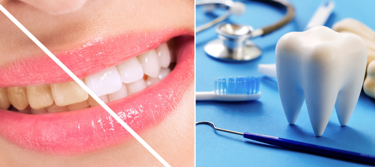 El alimento más dañino para los dientes, según dentista, no es 'ni el ...