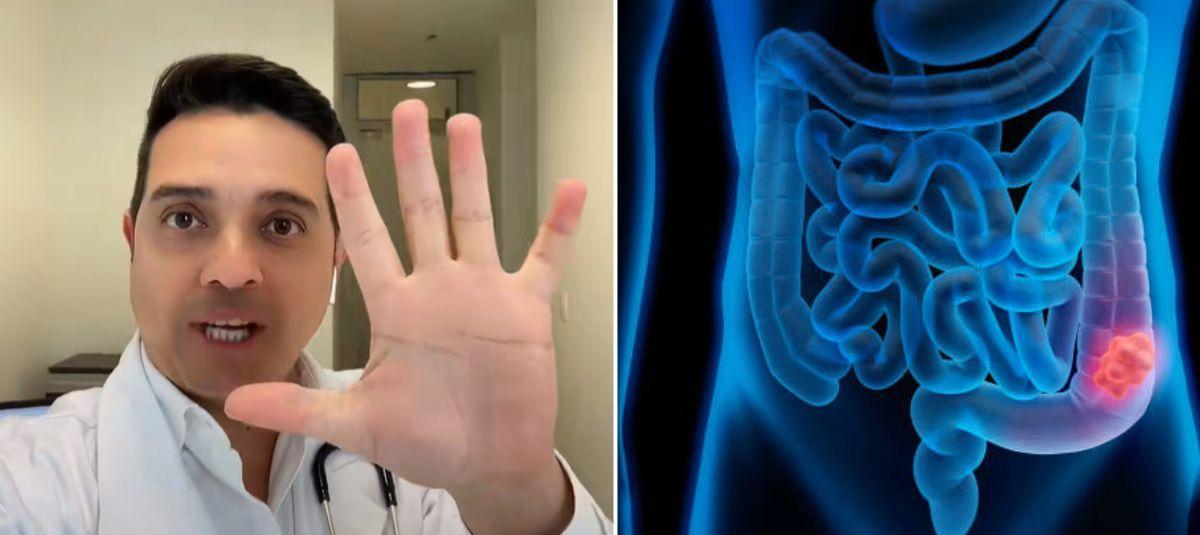 Cáncer de colon: estos son los 5 signos de alarma que debe tener en ...