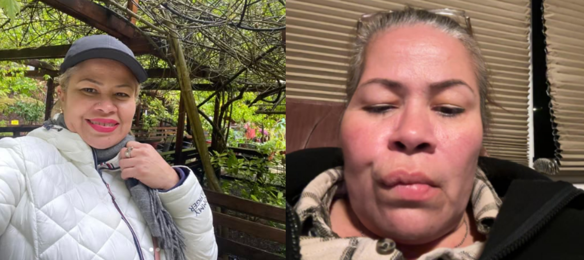 Yanine Castillo, exintegrante de las Hermanitas Calle, sufrió grave ...