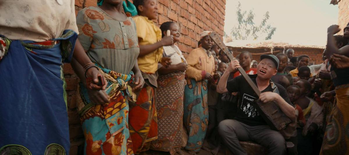 lazarus documental sobre albinos en Malaui David Darg director