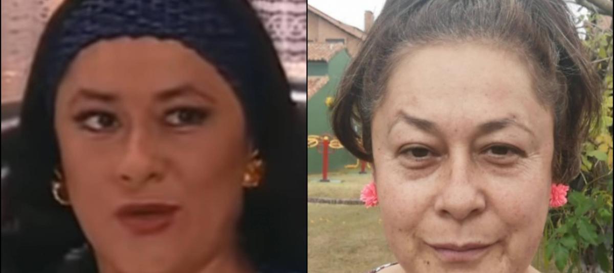 Pedro, el escamoso: ‘Nidia de Pachecho’ habla de enfermedad que padeció