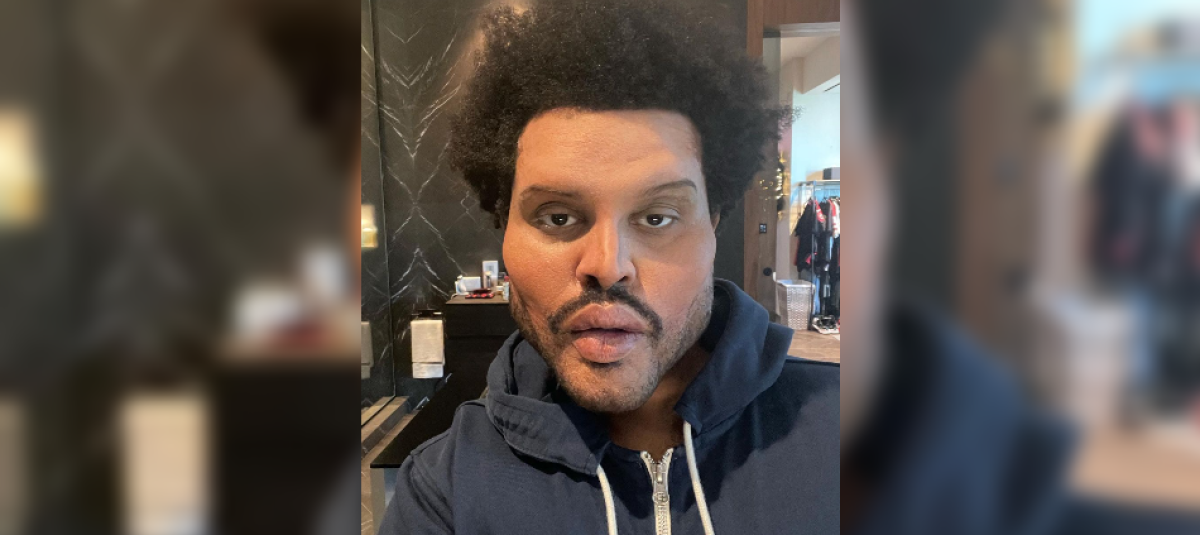 Cirugía Plástica ¿Qué le sucedió a The Weeknd en la cara?