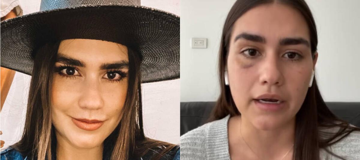 Johana Rojas: diseñadora denuncia que fue golpeada por su exnovio
