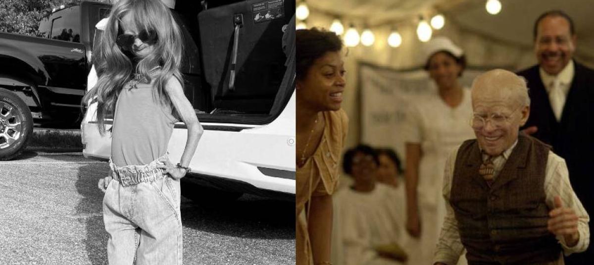 Adalia Rose Williams: joven que inspiró filme de Benjamin Button falleció