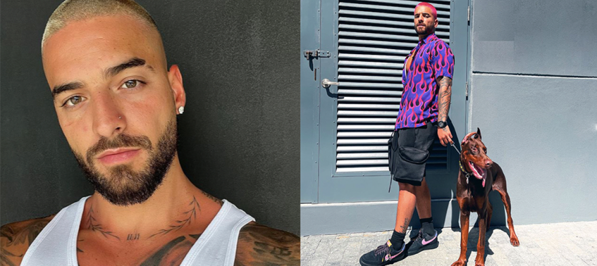 Maluma mostró cómo quedó su rostro tras ser mordido por su perro