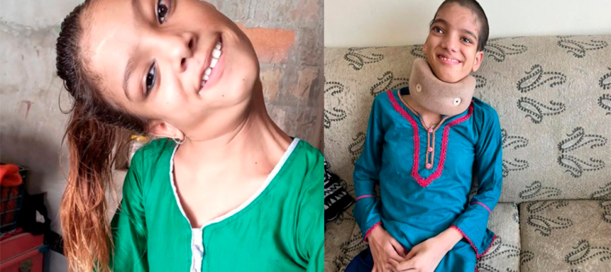 Afsheen Gul: historia de la niña que vivió con su cuello a 90 grados
