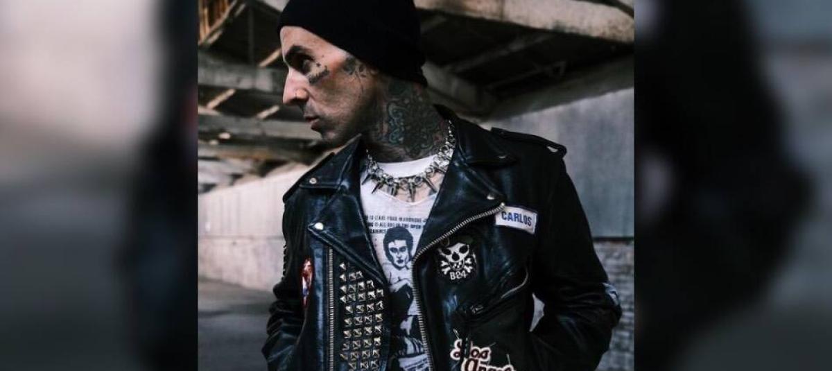 Travis Baker hospitalizado por pancreatitis