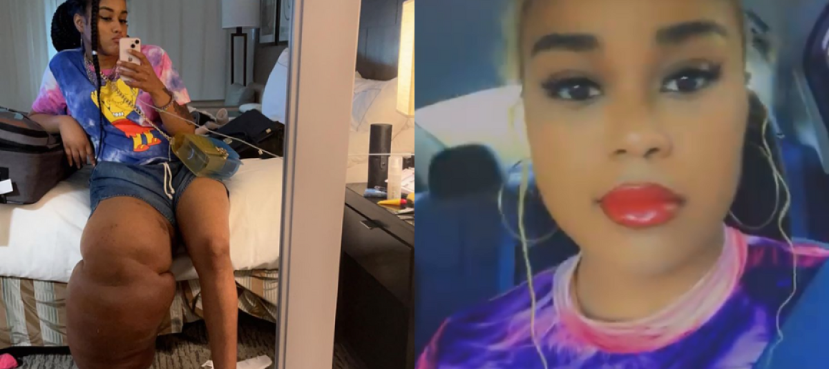 Mahogany Geter, la modelo con linfedema que tiene una pierna de 45 kilos