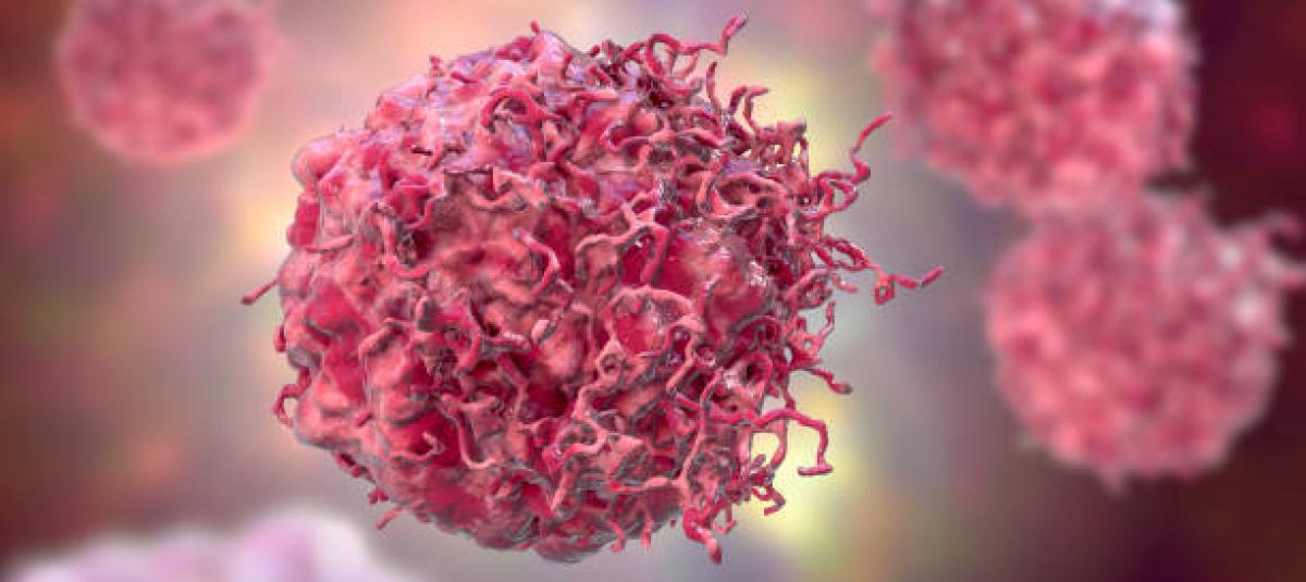 ¿Qué tipo de cáncer es un sarcoma y cómo se diferencia?