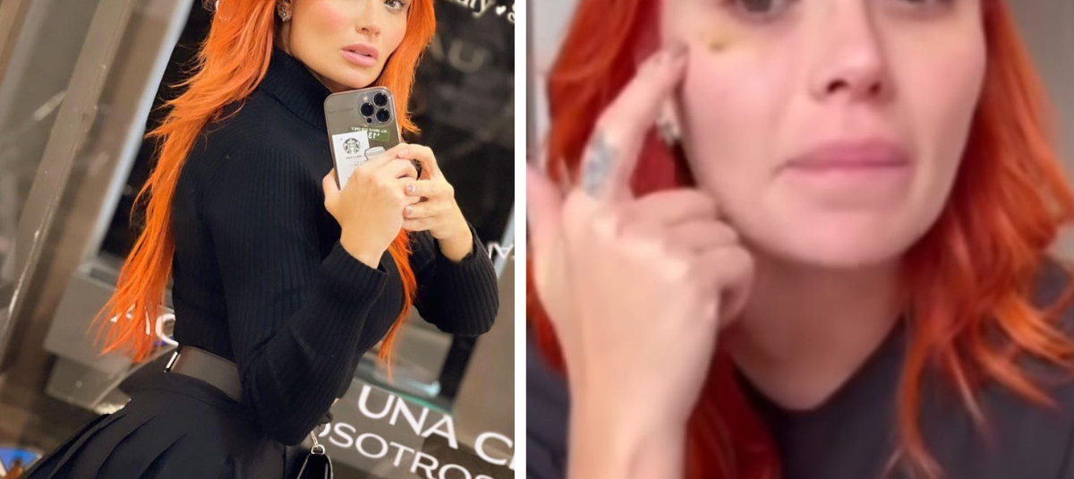 Sara Uribe se desmaquilla y explica por qué tiene un morado en la cara