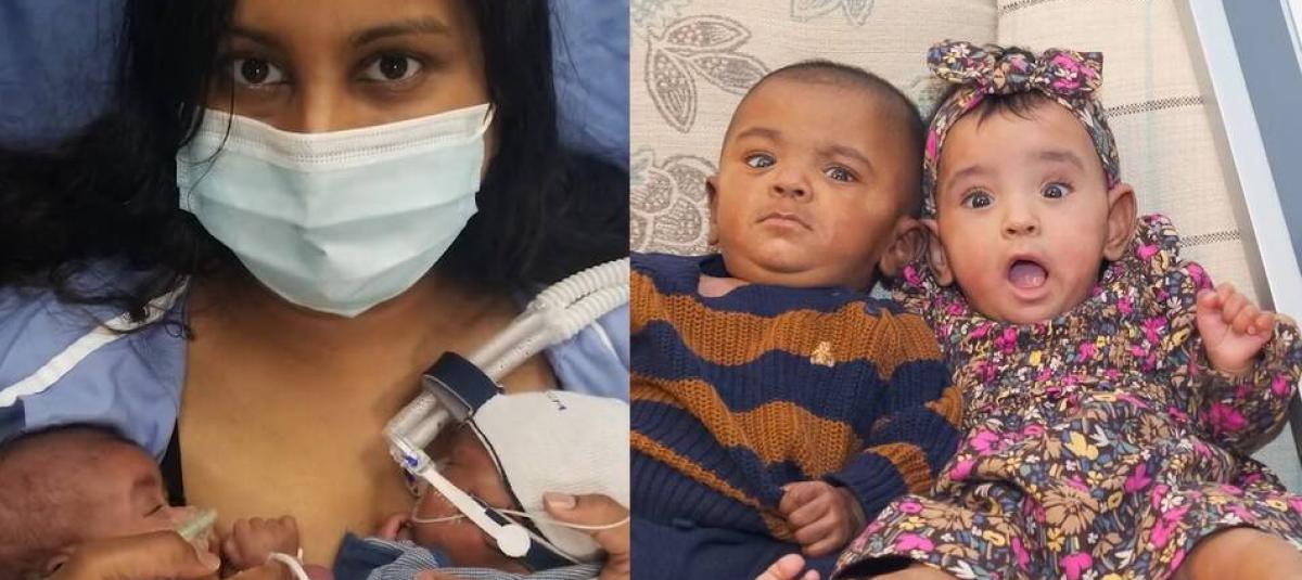 Los bebés más prematuros del mundo ya cumplieron un año