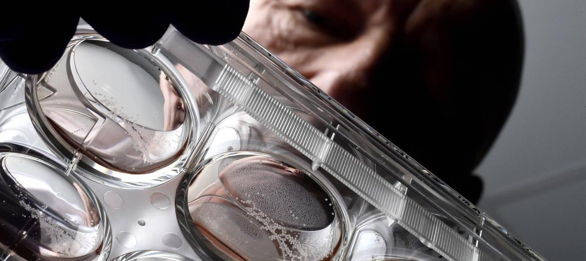 Entrevista con Thomas Hartung: el plan para crear computadores con células