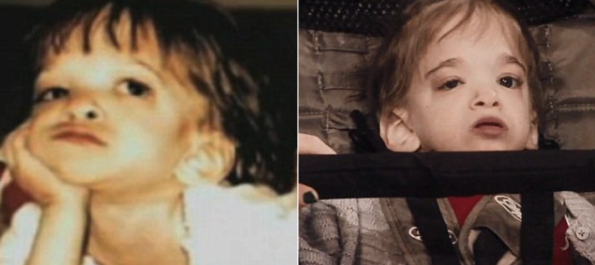 Brooke Greenberg: la bebé eterna que vivió 20 años en el cuerpo de una niña