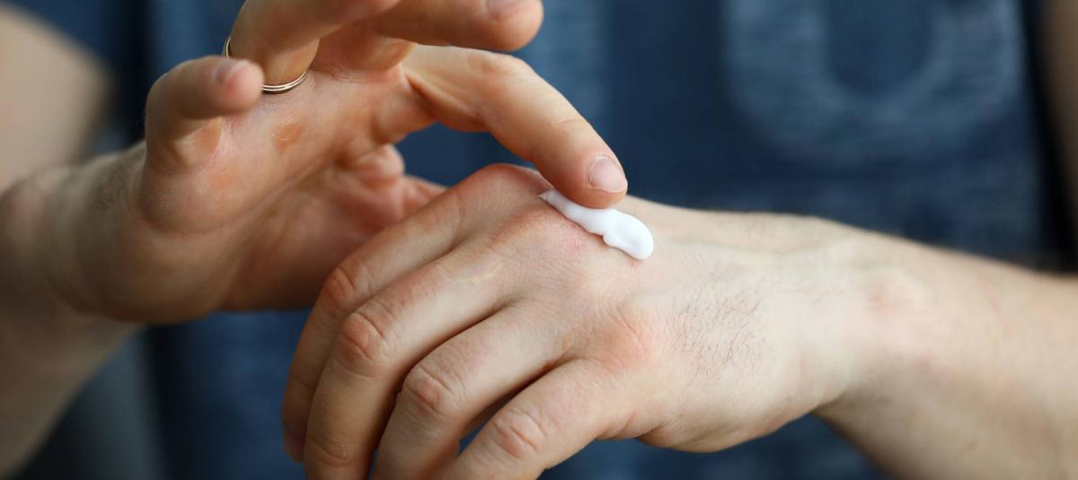 Eczema: Síntomas y causas de esta hinchazón de la piel