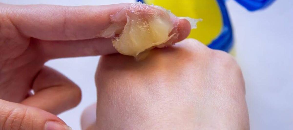 Así puede usar la vaselina para hidratar la piel