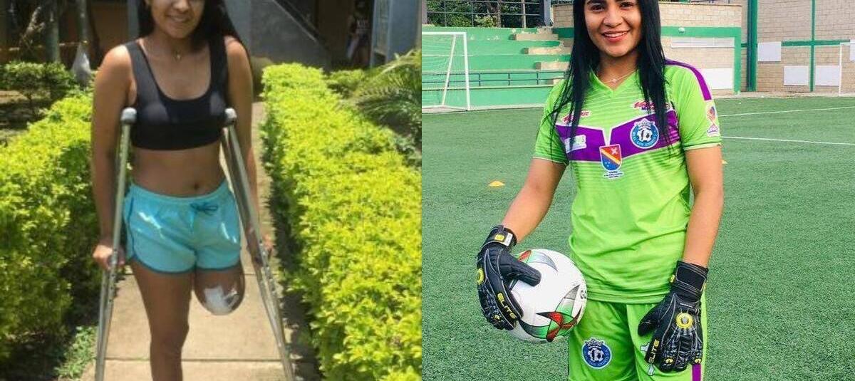 Johanis Menco, futbolista amputada, gana tutela tras tres años de accidente