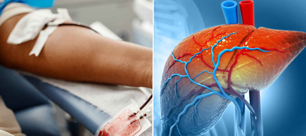 Gamma-glutamil transpeptidasa GGT alto: ¿cómo se realiza prueba y qué ...