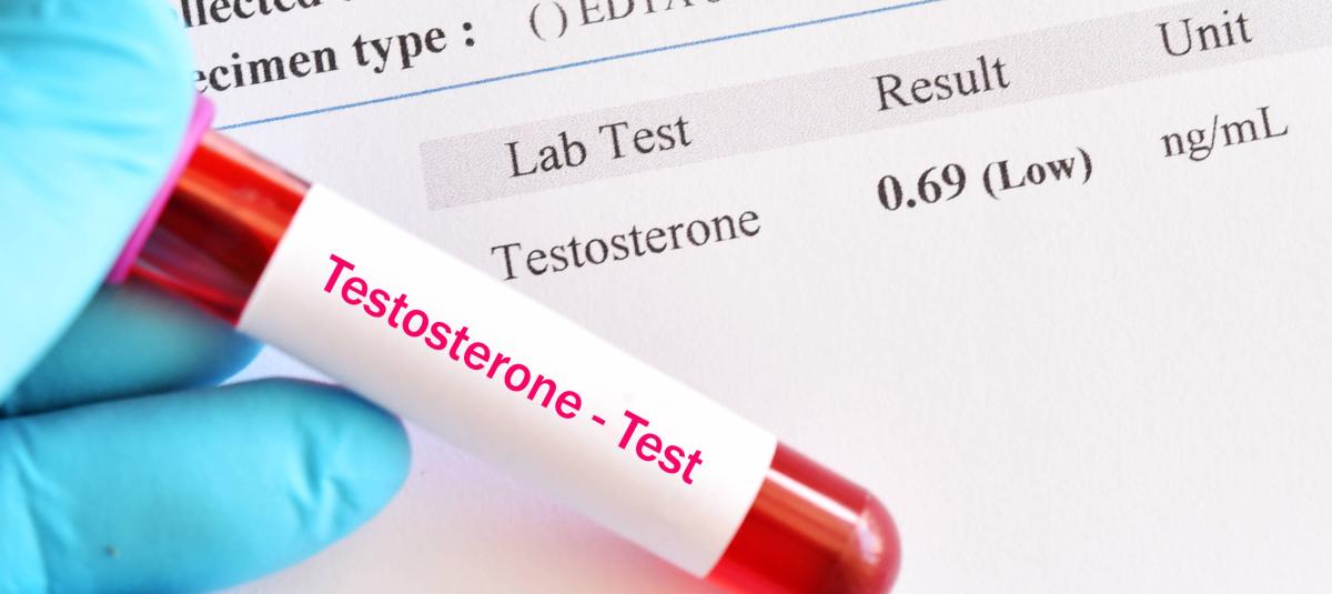 Terapia con testosterona está en auge: ¿para qué sirve y por qué es tan ...