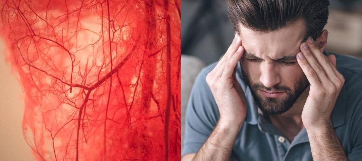 Vasculitis ¿qué Es Cómo Se Desarrolla Y Cuáles Son Sus Sintomas