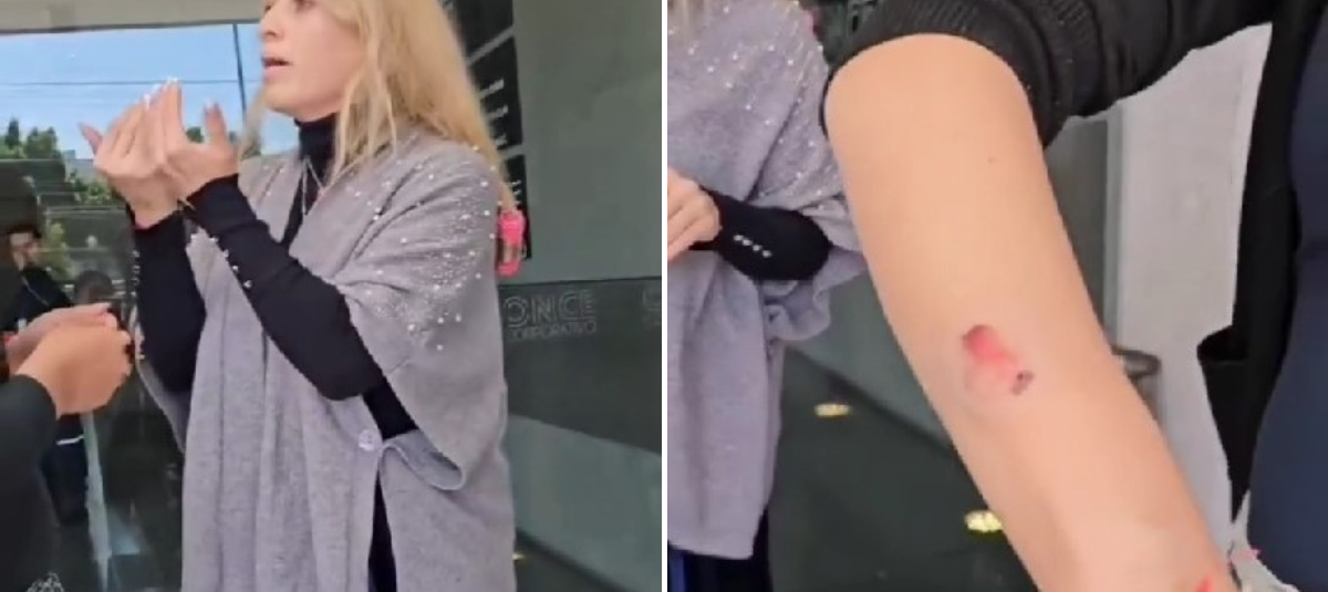 ‘Lady mordidas’: mujer atacó a mordiscos a manicurista para no pagarle ...