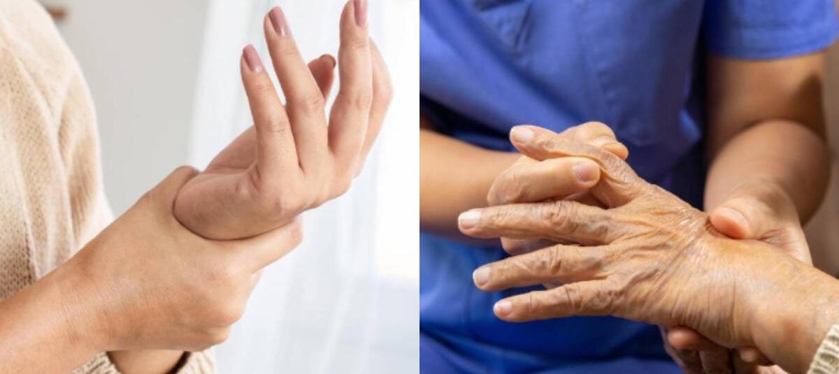 Artralgia: ¿qué es este tipo de dolor en las articulaciones y cuál es ...