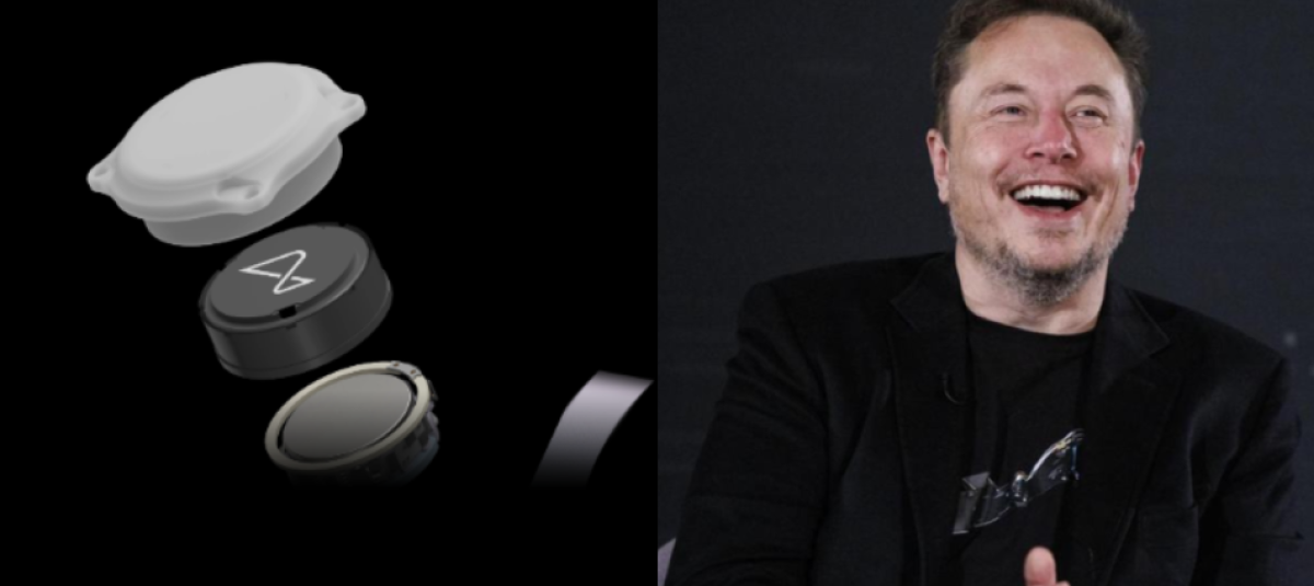 Blindsight, el chip cerebral con el que Elon Musk promete restaurar la ...