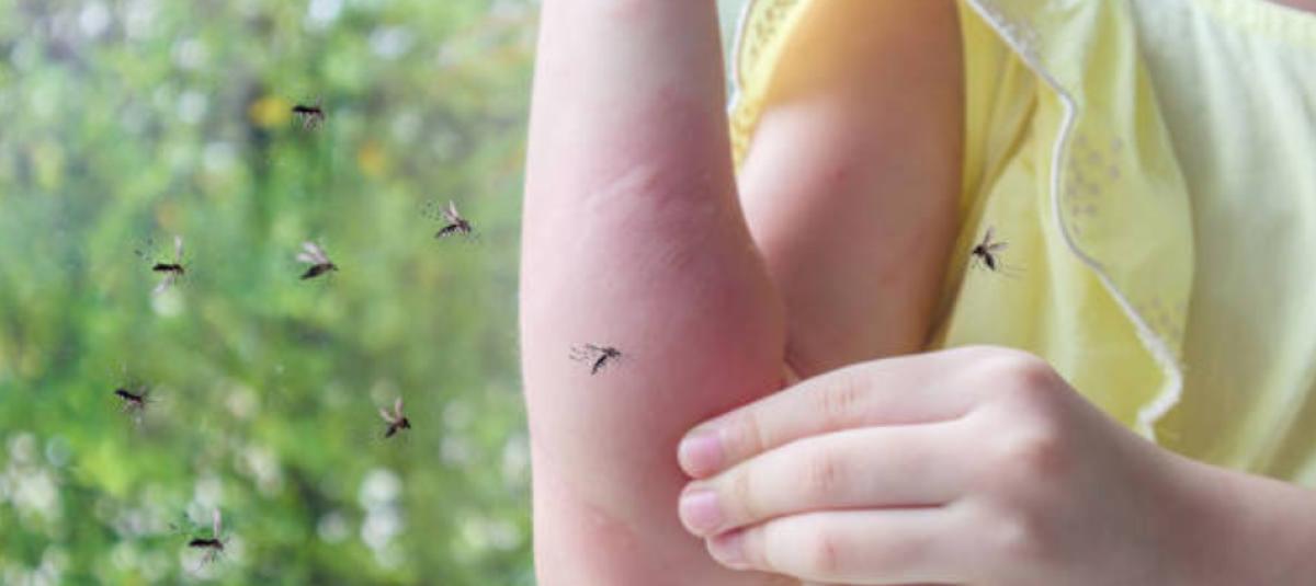 ¿Qué bicho me picó? Sepa por la apariencia de la roncha cuál insecto lo ...