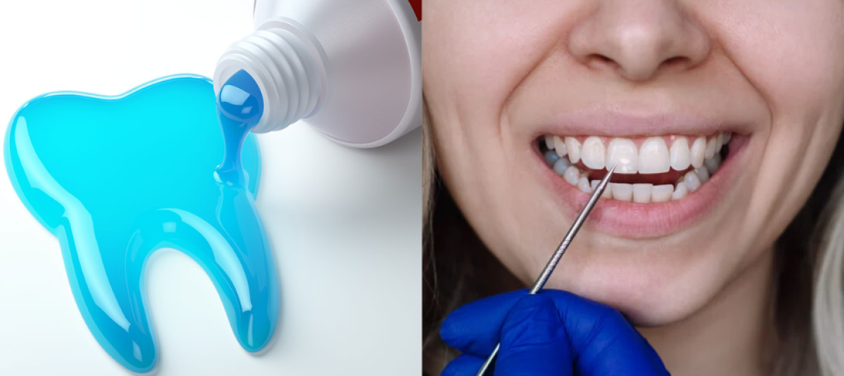 ¿Es seguro el uso de flúor para prevenir la caries? Controversias y evidencias científicas