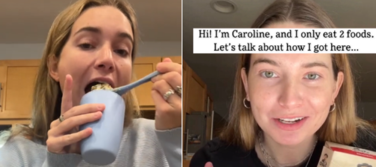 Debido a una rara enfermedad, un solo beso podría matarla: el caso de ...