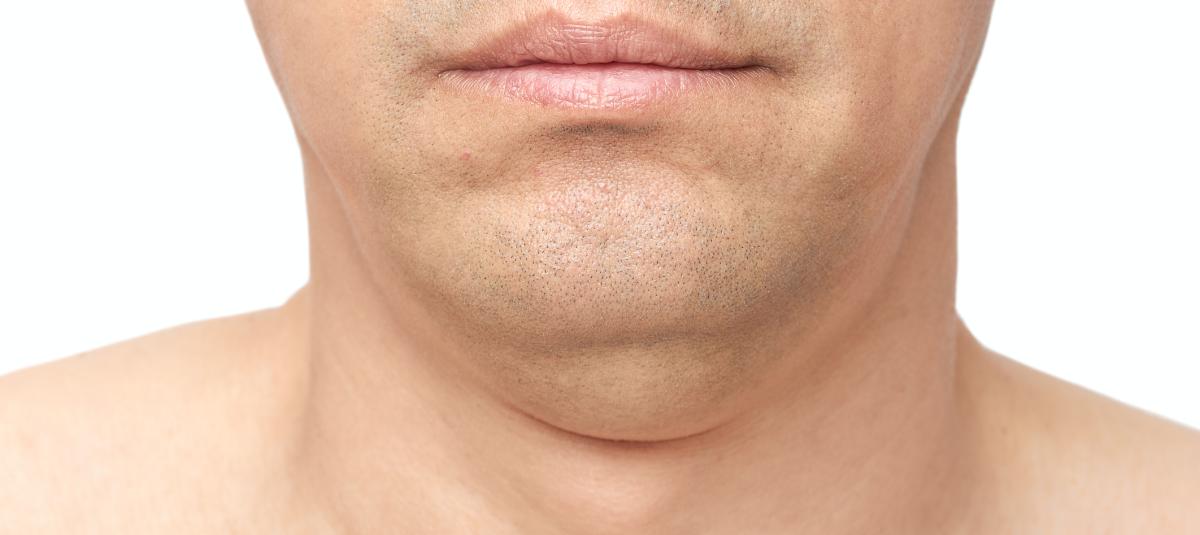 Experta en yoga facial da el 'truco' para eliminar definitivamente la ...