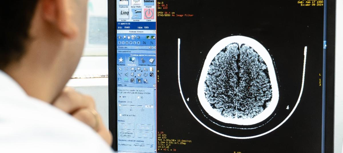 Tenga en cuenta: en Colombia aumentan los casos de ACV en jóvenes ...