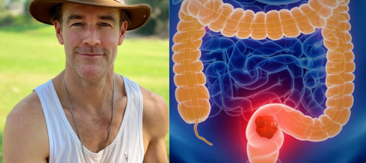 James Van Der Beek, protagonista de ‘Dawson's Creek’, revela que padece ...