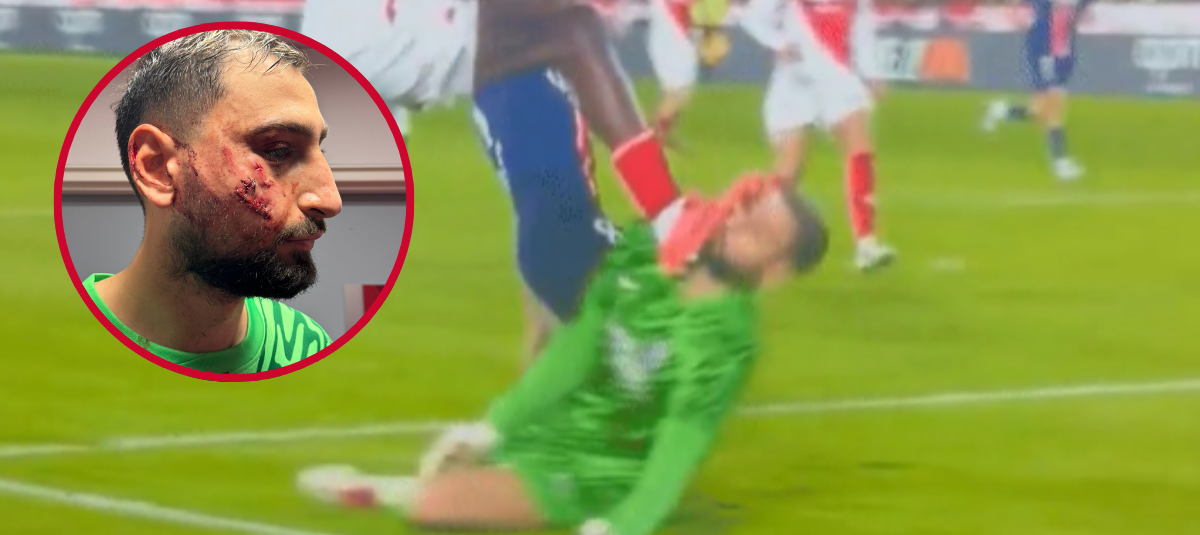 Video| La fuerte patada que recibió Donnarumma en medio de un partido: así quedó el arquero