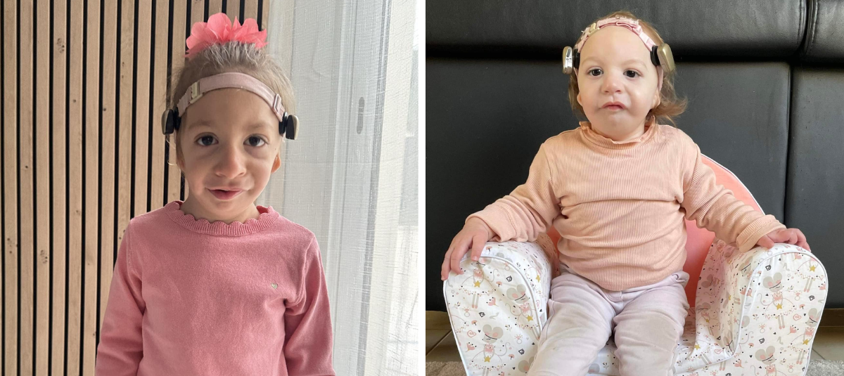 Margot, niña que nació sin orejas, tímpanos ni canales auditivos y ...