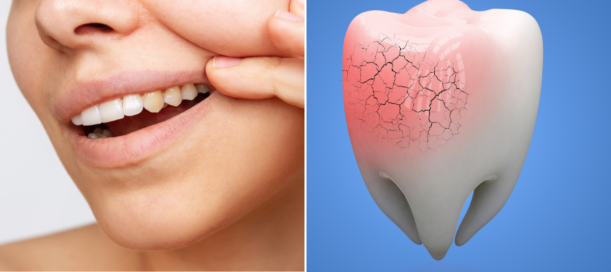 Odontóloga enumera los nutrientes que hay que consumir para mantener el ...