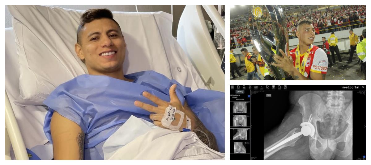 Juan Daniel Roa, el drama de jugar al fútbol con dolor y que el dolor ...