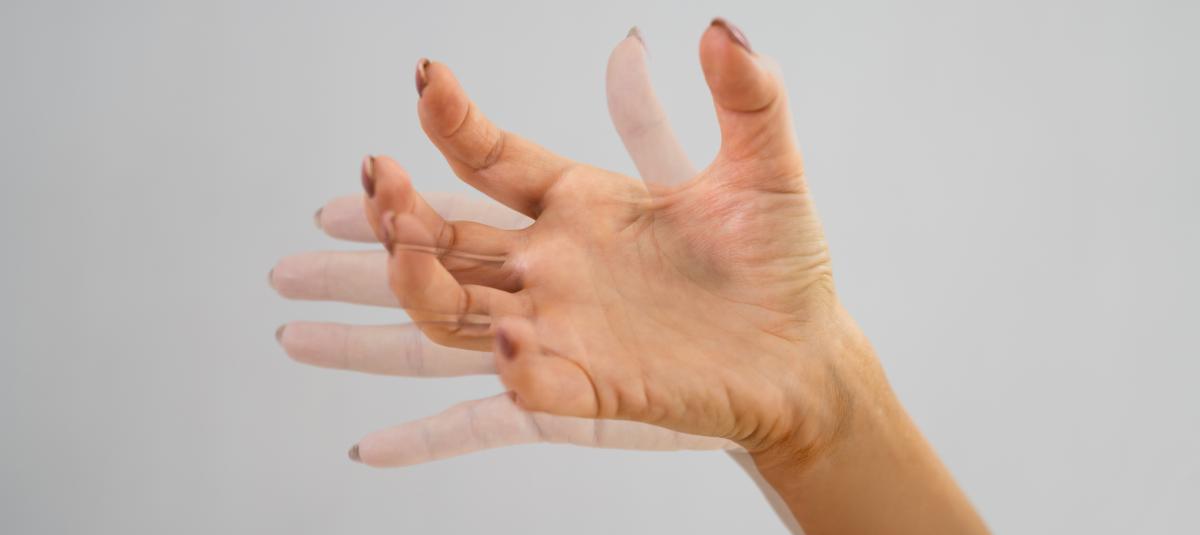 FDA aprueba dispositivo que se implanta en el cerebro y disminuye los síntomas del parkinson ...