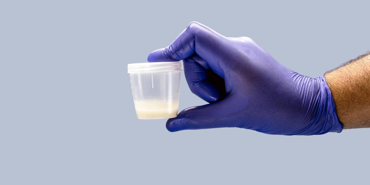 Alimentos que ayudan a producir esperma: la dieta que mejora la calidad del semen