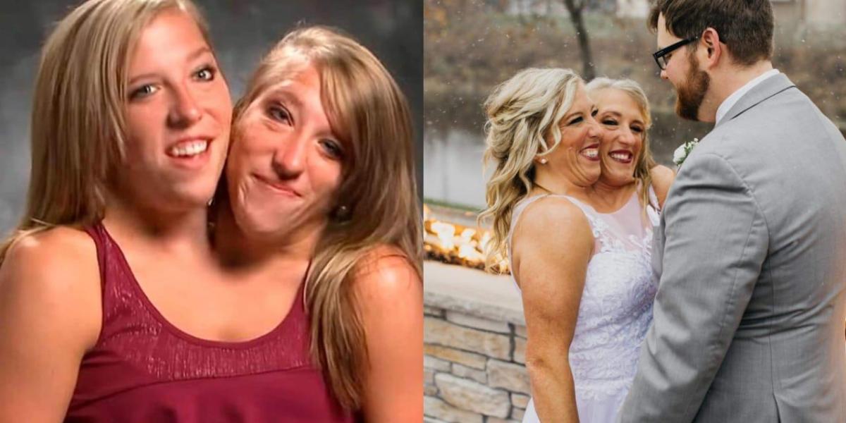 Abby y Brittany Hensel: una de las siamesas unidas por el cuello se casó