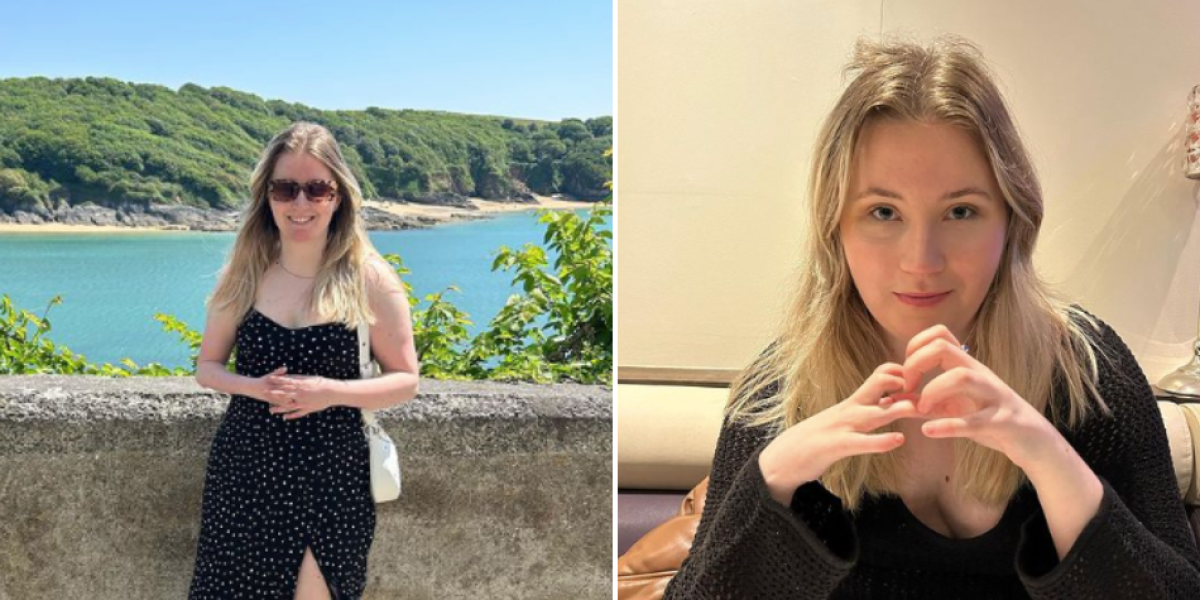 Caron Mills, joven con síndrome de Poland víctima de matoneo en Inglaterra