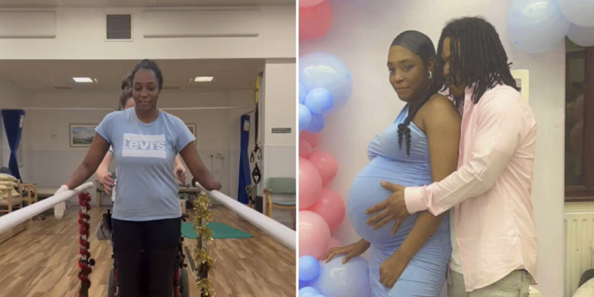 A madre le tuvieron que amputar piernas, dedos y una mano días después ...