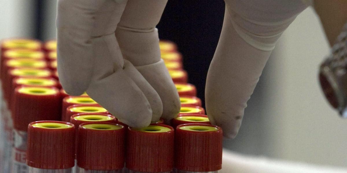 ¿Cuáles son las pruebas de laboratorio más comunes y su importancia?