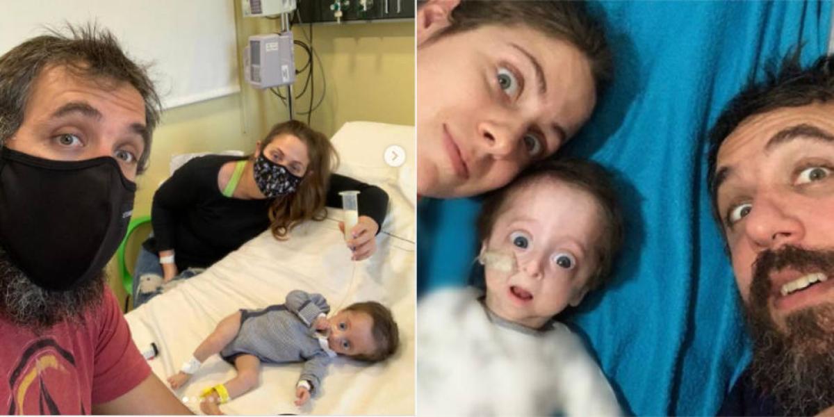 Vito: la historia del bebé que padece Progeria como Benjamin Button