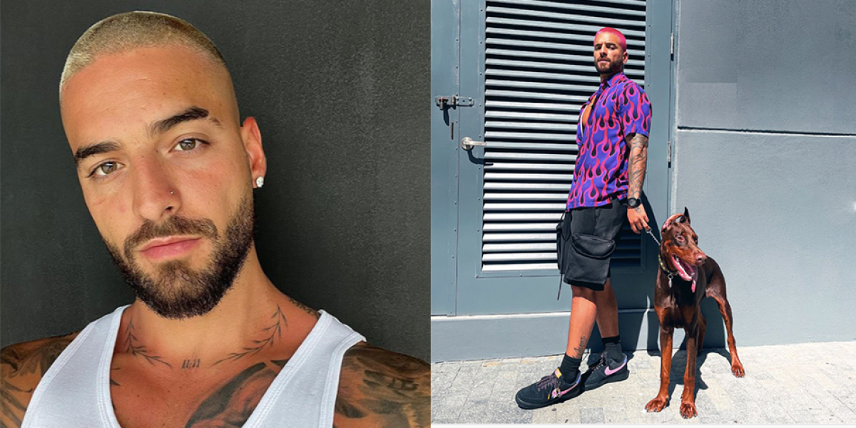 Maluma mostró cómo quedó su rostro tras ser mordido por su perro
